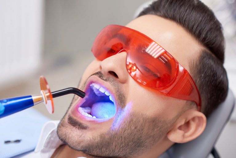 Temporary Filling | Emergency Dentist London