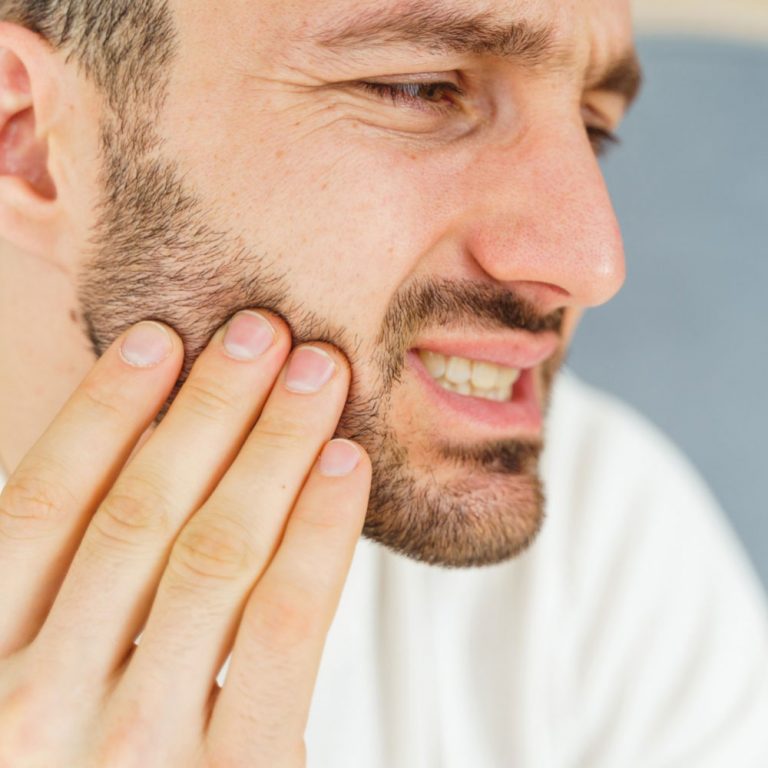 ANUG (Acute Necrotising Ulcerative Gingivitis) | London