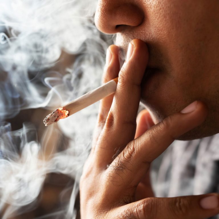 ANUG (Acute Necrotising Ulcerative Gingivitis) | London